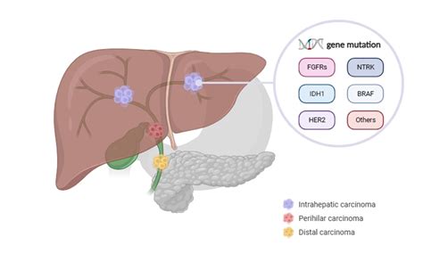 Topic Challenges And Opportunities For Treating Intrahepatic Cholangiocarcinoma
