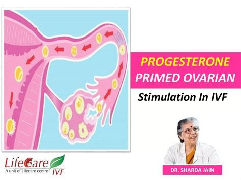Progestin Primed Ovarian Stimulation Ppos Is A New Dawn In Ovarian Stimulation Protocol In Ivf