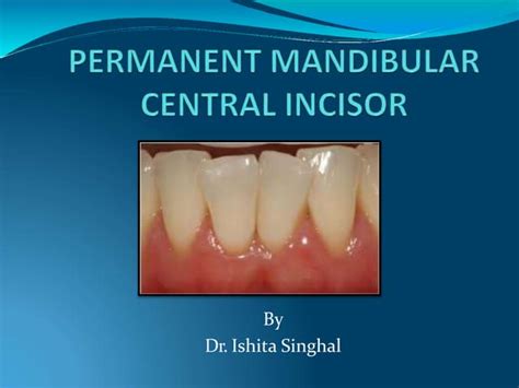 Permanent Mandibular Central Incisor Pptx