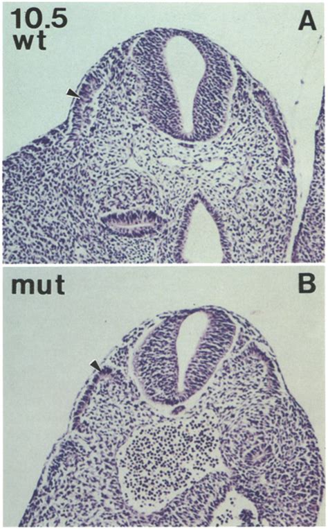 Somite And Early Muscle Development In Myogeninmutant Embryos The Download Scientific Diagram
