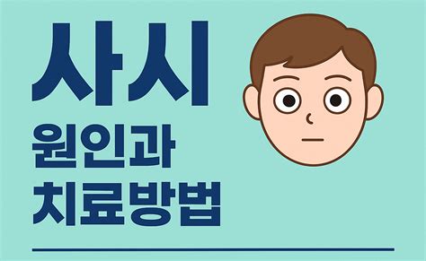 👁️ Strabismus Causes And Treatment Self Test Methods You Can Try At Home