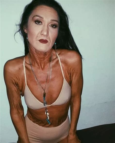 Brave Year Old Woman With Rare Skin Condition That Makes Her Look Decades Older Launches