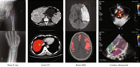 Mean Average Precision In Object Detection A Comprehensive Guide Encord
