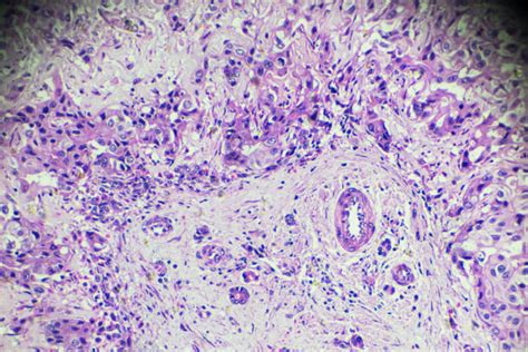 Colorazione Ematossilina Eosina Immagine Foto E Immagini Stock Istock