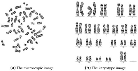 Full Set Of Extra Chromosomes At Beau Nicolay Blog