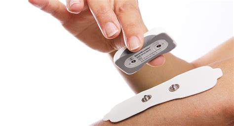 Stimrouter Neuromodulation Device Aran Rd