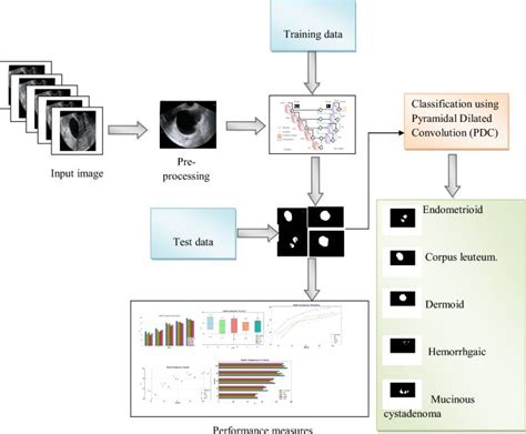 Segmentation Of Ovarian Cyst In Ultrasound Images Using Adaresu Net