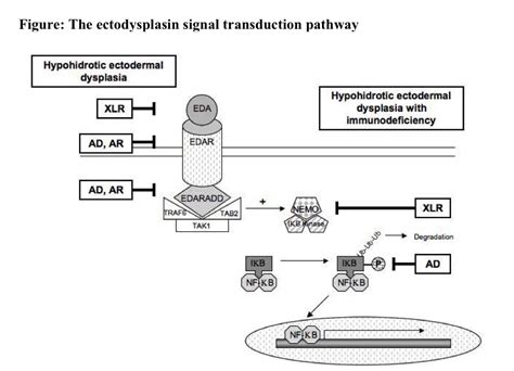 Xlinked Ectodermal Dysplasia With Immunodeficiency Caused