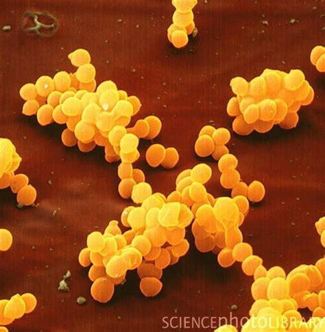 Lost And Found Staphylococcus Aureus Mssa Golden Cluster Seed
