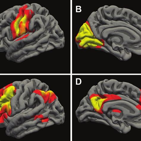 Construction Of A Functional Brain Network Functional Mri Fmri