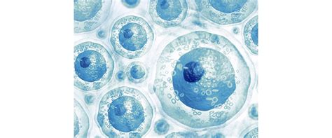 Inheritance Of Ichthyosis Exporter China