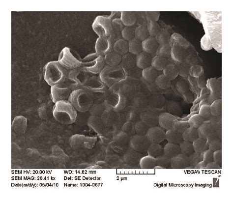 Sem Photomicrographs Of The Spherical Bacteria Fossils And The Colonial