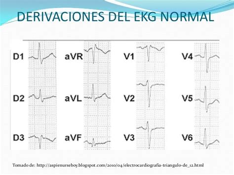 12 Derivaciones Ecg Normal Almacenamiento De Archivos