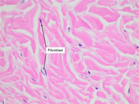 Fibroblasts In Connective Tissue