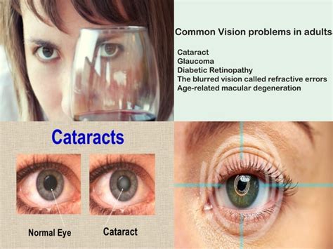 The Different Types Of Vision Problems Pdf
