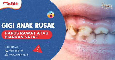 Anatomi Gigi Pengertian Bagian Dan Struktur Anatomi Gigi