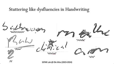 Stuttering May Be More Than A Speech Disorder