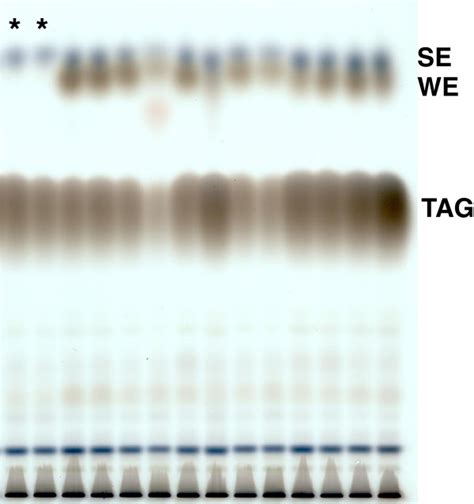 Thin Layer Chromatographic Separation Of Seed Lipid Extracts Download Scientific Diagram