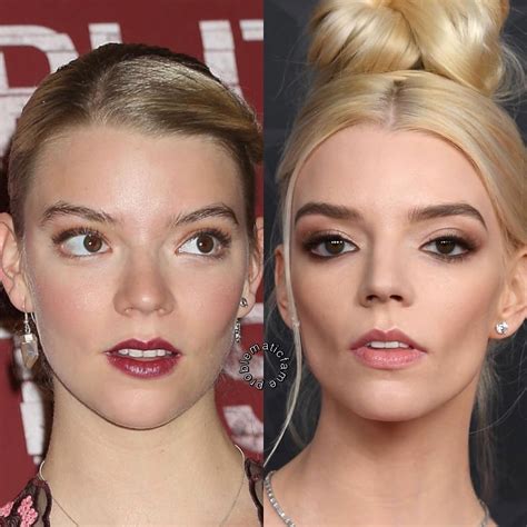 Problematic Fame Anya Taylor Joy Then Now Reminder My Posts Are