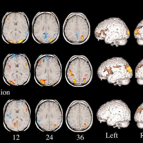 Brain Activations Across The Three Conditions Left Panel Averaged