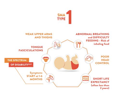 Types Of SMA
