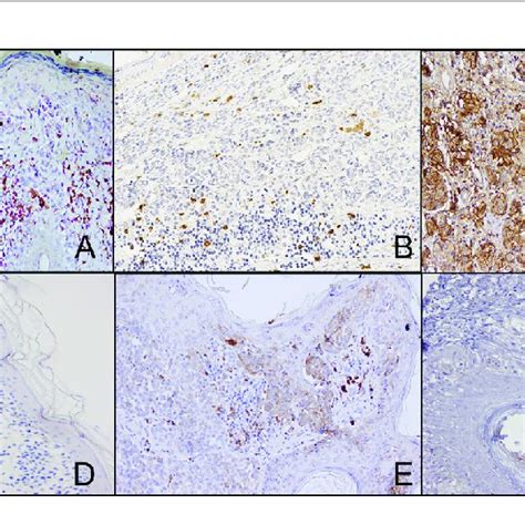 Representative Staining Patterns Of Formalin Fixed Paraffin Embedded Download Scientific