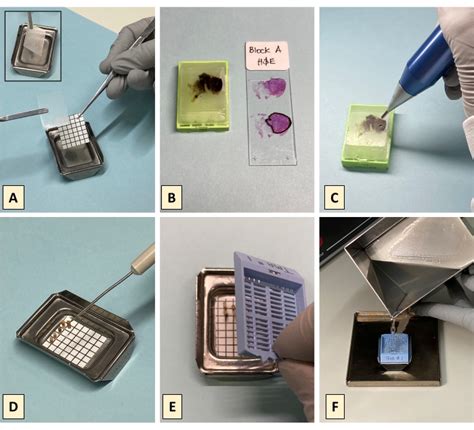 Manual Construction Of A Tissue Microarray Using The Tape Method And A
