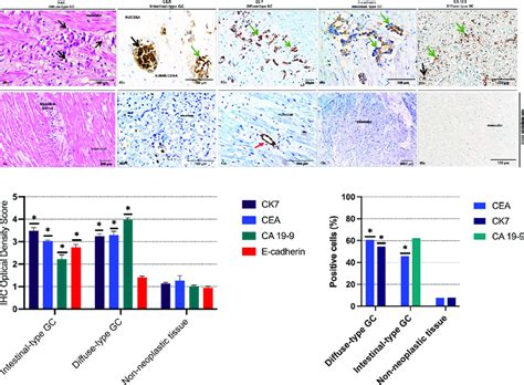 Expression Of Tumor Markers In Tissue Samples From Patients Diagnosed Download Scientific