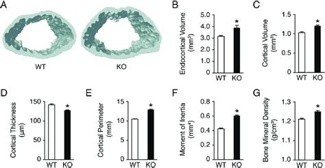 Trabecular Bone Structural Analysis Of Wild Type Wt And Tr Deficient Download Scientific
