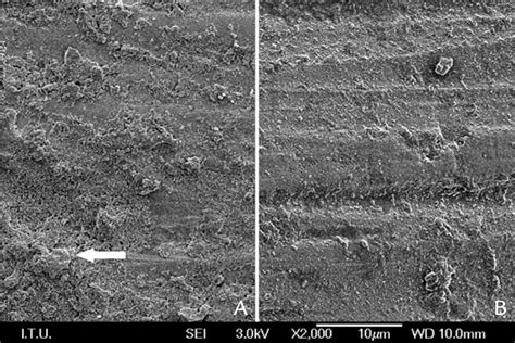 Influence Of Different Surface Treatments On The Short Term Bond Strength And Durability Between