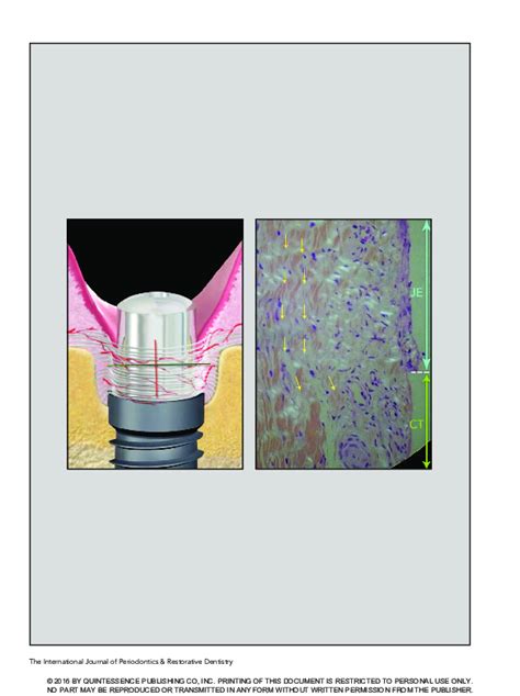 Pdf Human Histologic Evidence Of A Connective Tissue Attachment To A
