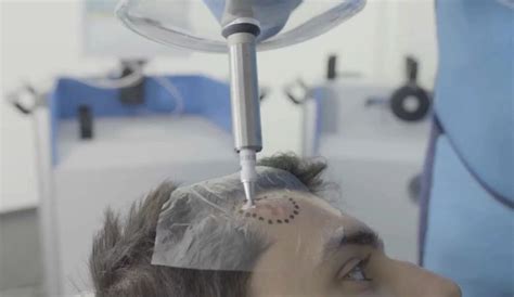 Ross Wright On Linkedin Medtech Skincancer Healthcare