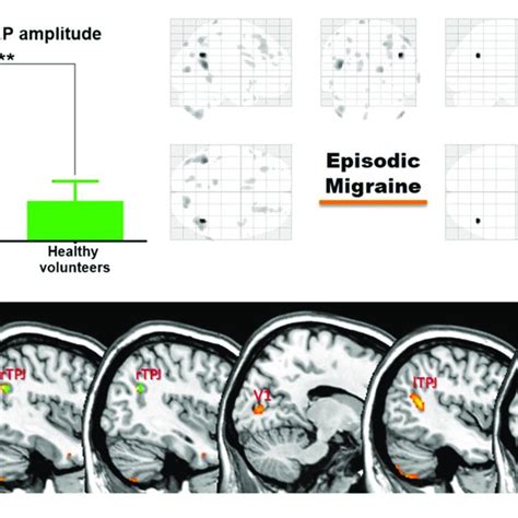 Top Left Bar Graph Of Amplitudes Of Single Trial Visual Evoked