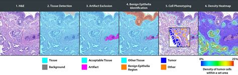Lung Macrodissect Ai Indica Labs Lung Macrodissect Ai Indica Labs