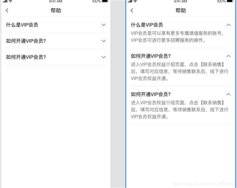 Vue实现折叠收起功能 展开收起功能vue实现一个div层的展开折叠效果 Csdn博客
