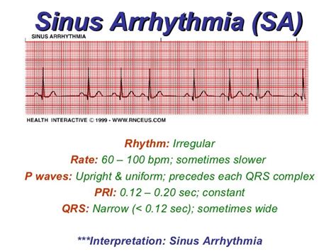Sinus Rhythms Bmhtele