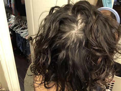 Not Actually A Bald Spot Curlyhair