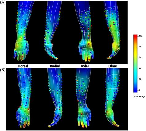 Epitrochlear Lymph Nodes Lymph Node Regions Illustration Radiology