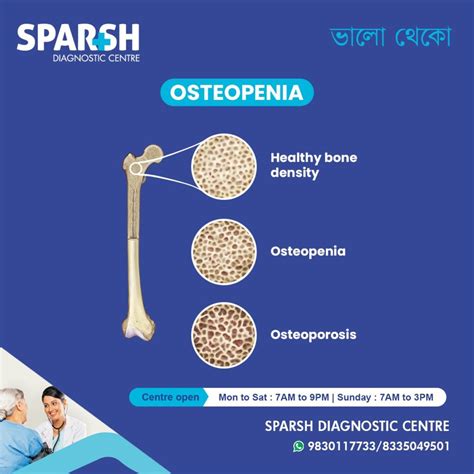 Osteopenia Sparsh Diagnostic Center