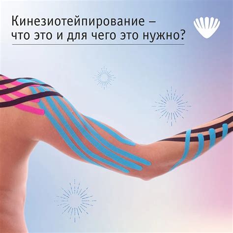 Кинезиотейпирование – что это и для чего нужно? - Новости МЦ «ЛОТОС»