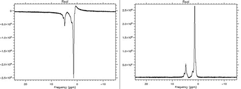 The Method Of Correcting Phase Artefacts Download Scientific Diagram