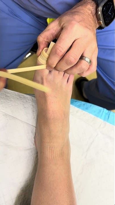 Learn To Use A Penrose Drain As A Digital Tourniquet Youtube