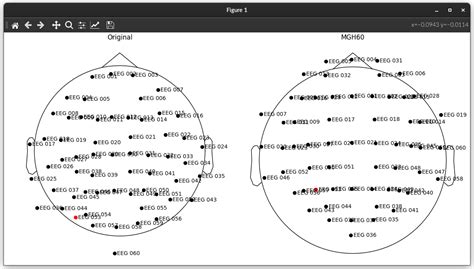 Bug Mgh60 Montage Is Incorrect For Sample · Issue 11285 · Mne Tools
