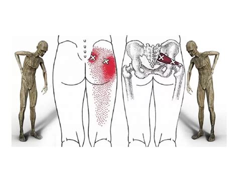 Stretch Sciatica Drs Lila And Samuel Flagler