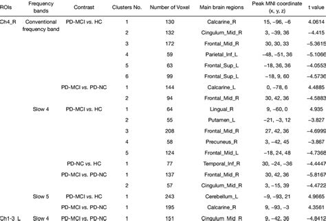 Brain Regions Showing Significant Functional Connectivity Differences Download Scientific