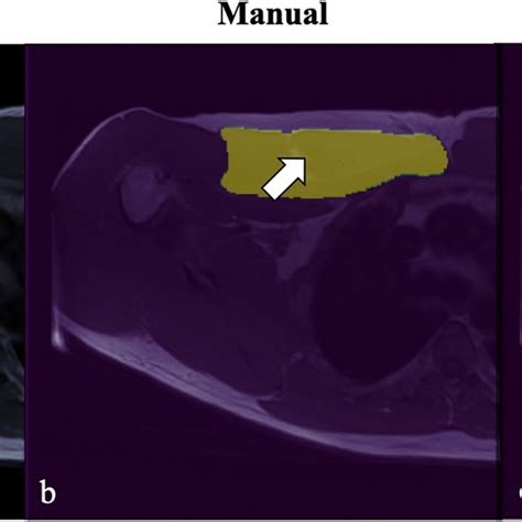prediction error on test images segmentation error at the lateral