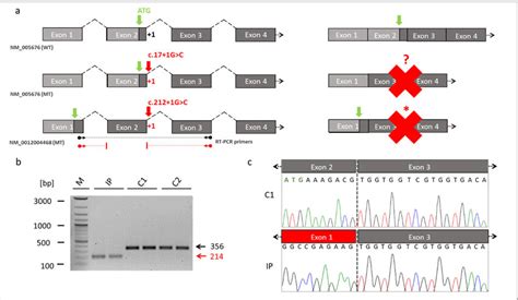 Skipping Of The Exon 2 In Rbm10 A Schematic Drawings Of The Exons Of