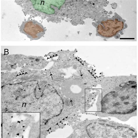 Establishment Of Atypical Perivascular Lymph Node Niches Ad