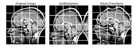 Data Augmentation Data Augmentation