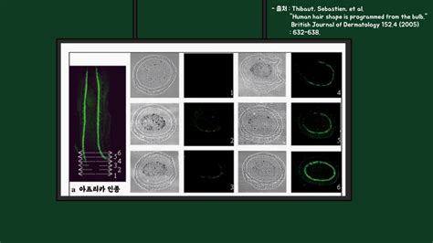 곱슬머리는 어떻게 결정되는 걸까